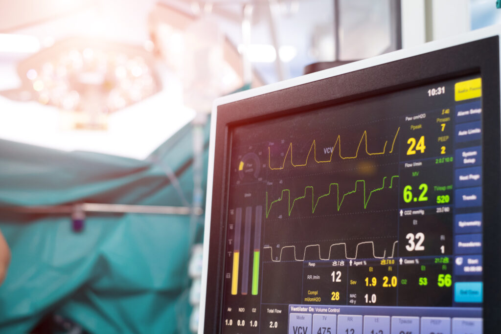 The Mechanisms of Capnography for Anesthesia